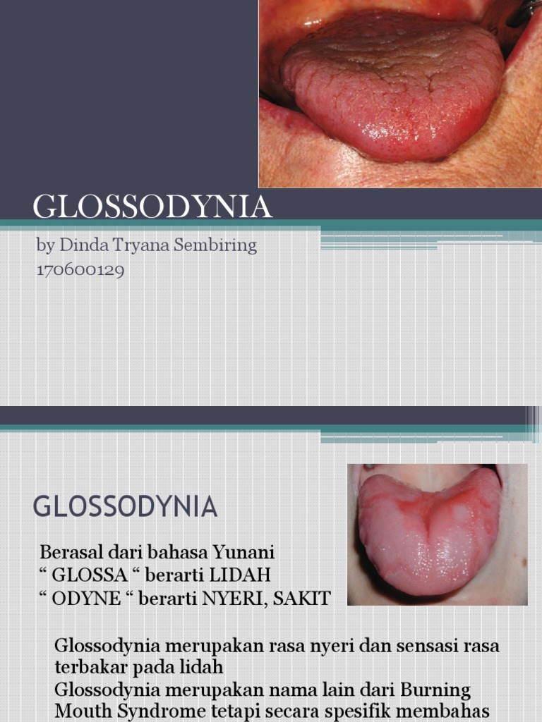 Panduan Lengkap Glossodynia | PDF