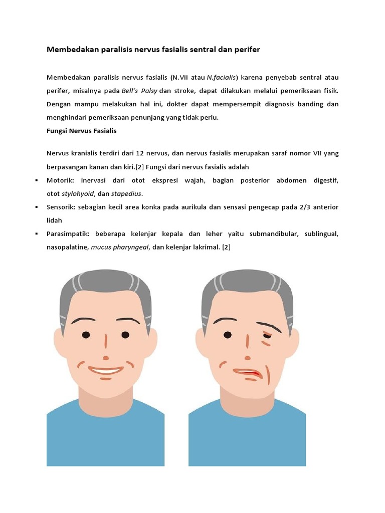 Membedakan Paralisis Nervus Fasialis Sentral Dan Perifer | PDF