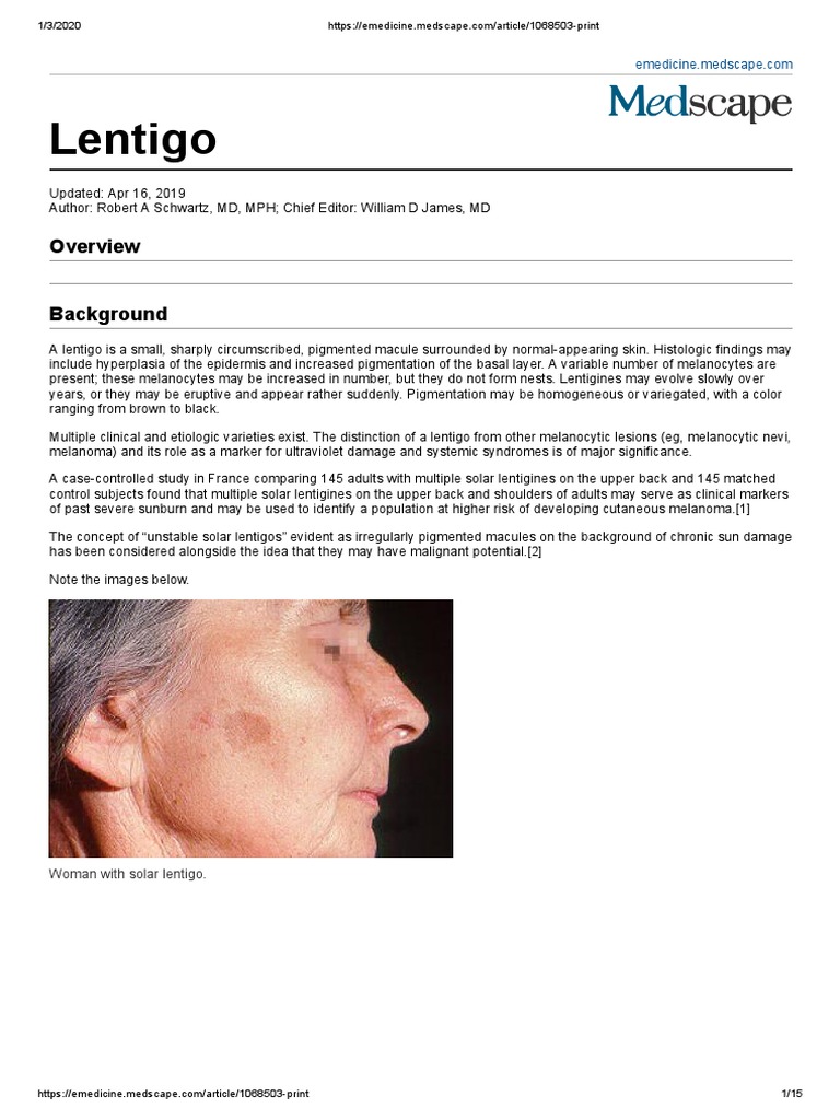 Lentigo | PDF | Epidermis | Melanoma