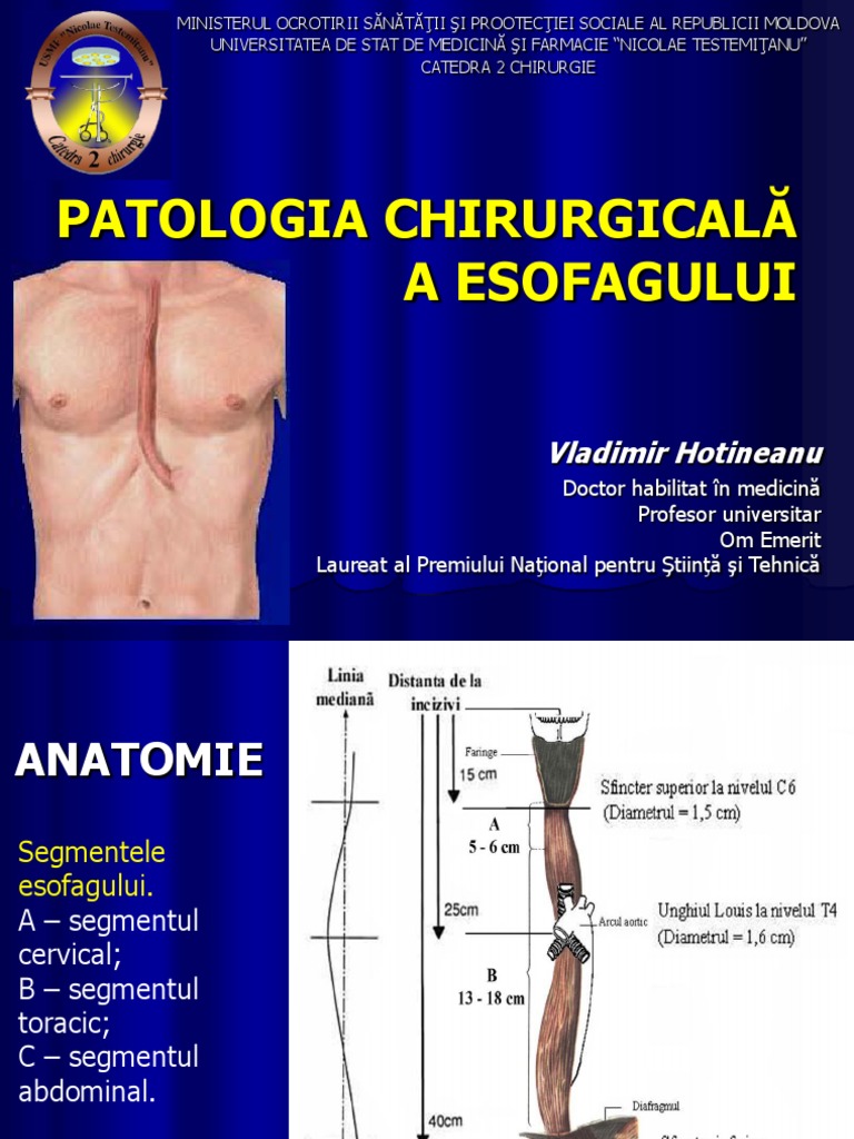 Patologia Chir Esofagului | PDF