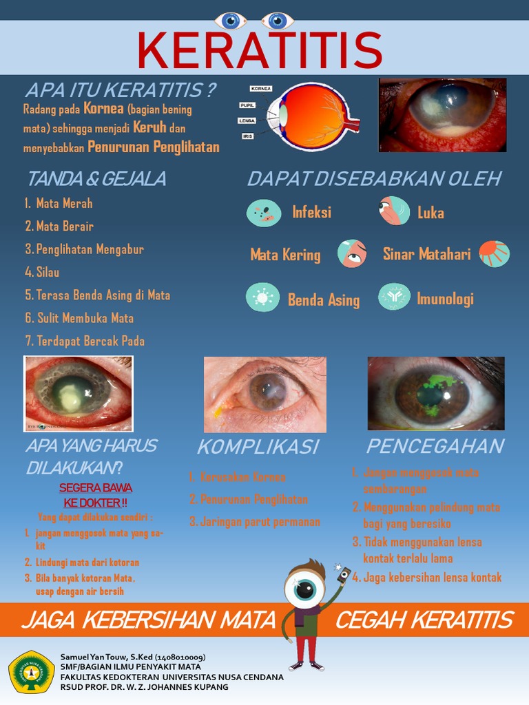 Poster Keratitis | PDF