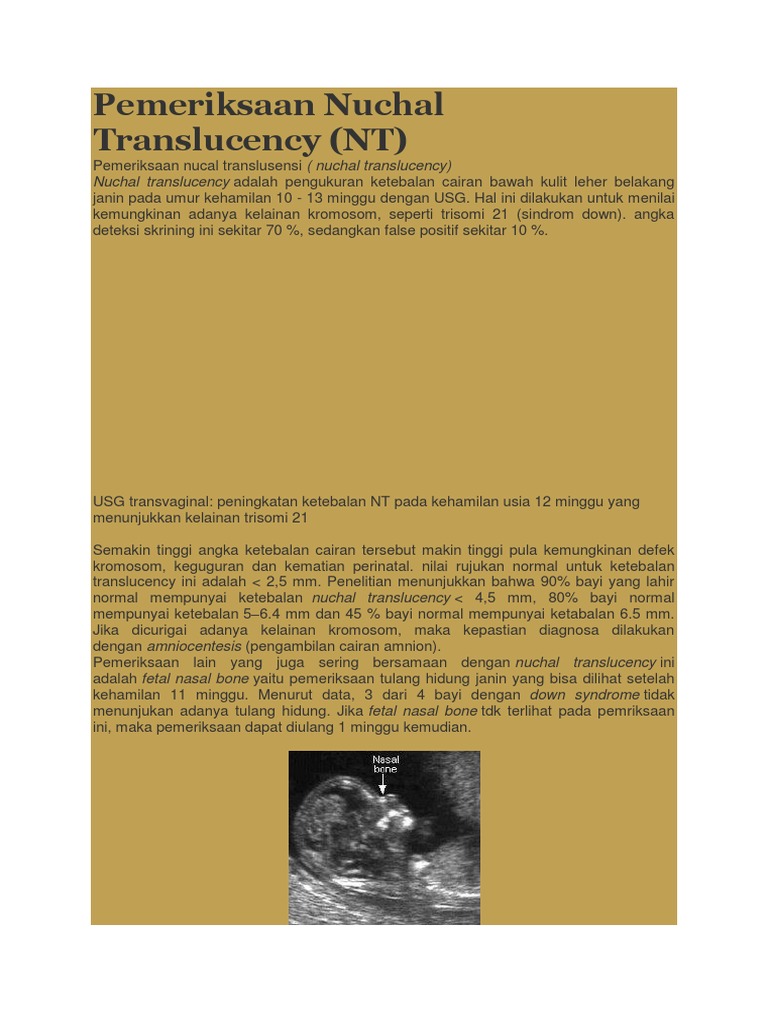 NT USG Screening Down Syndrome | PDF