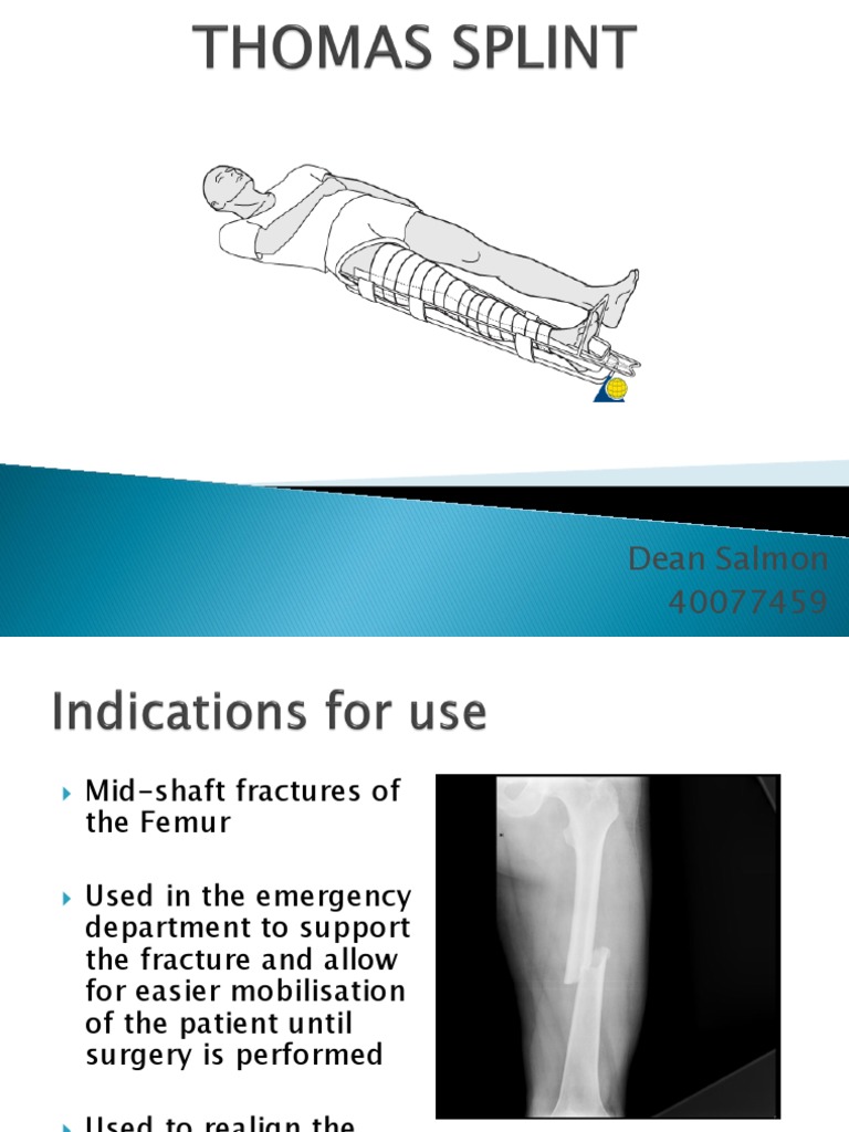 Thomas Splint | PDF | Human Leg | Musculoskeletal System