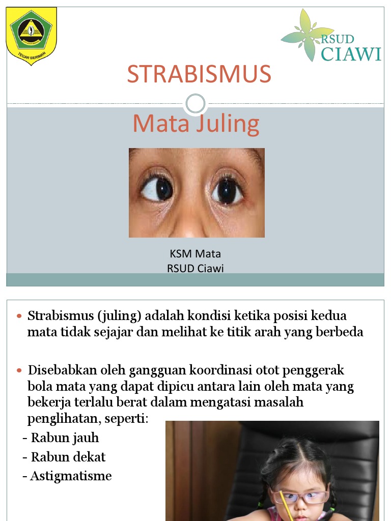 Strabismus | PDF
