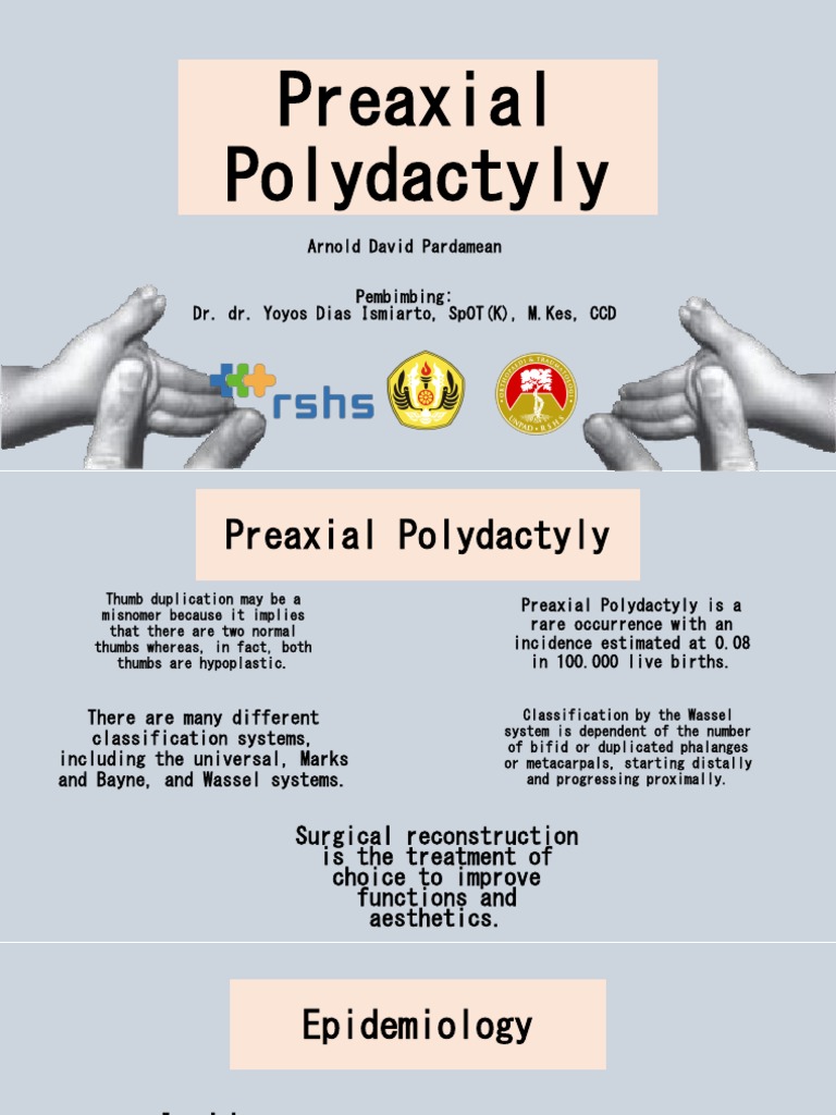 Preaxial Polydactyly (New) | PDF | Thumb | Hand