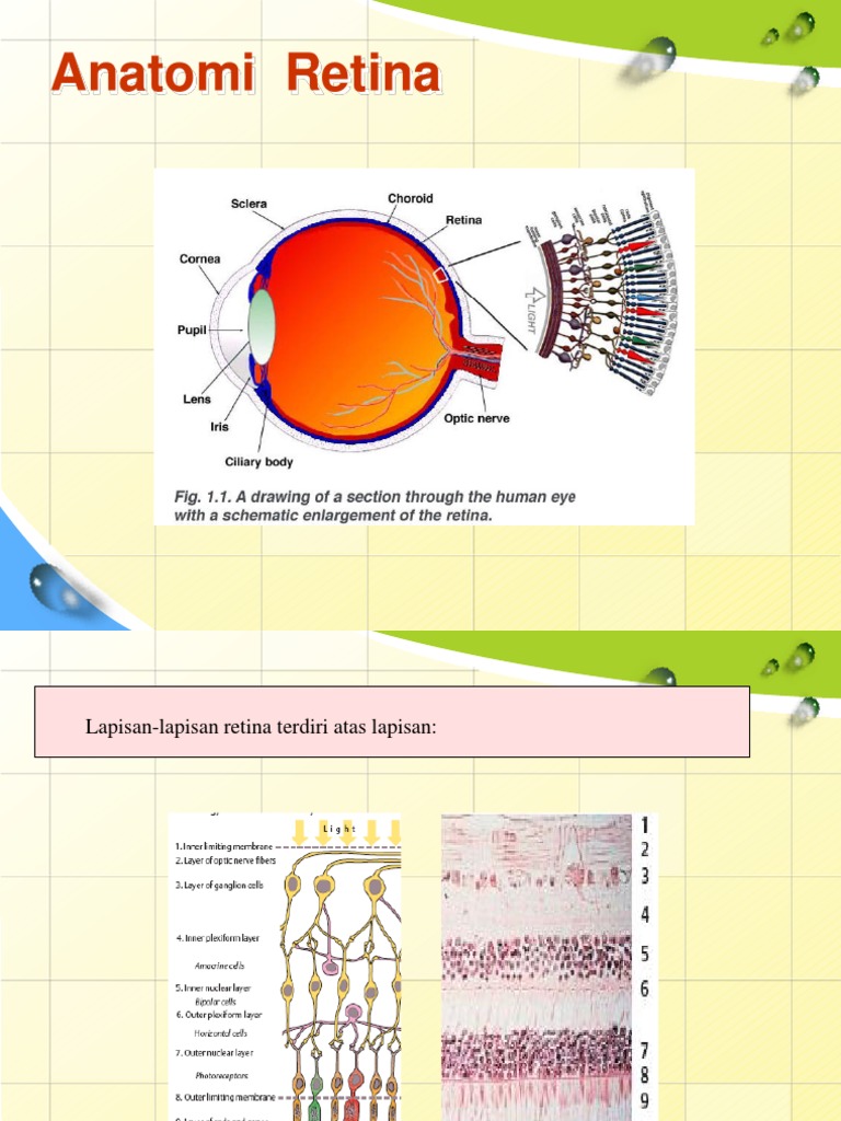 Central Retinal Artery Occlusion (CRAO) | PDF