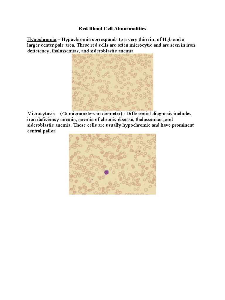 Red Blood Cell Abnormalities | PDF | Anemia | Hematology