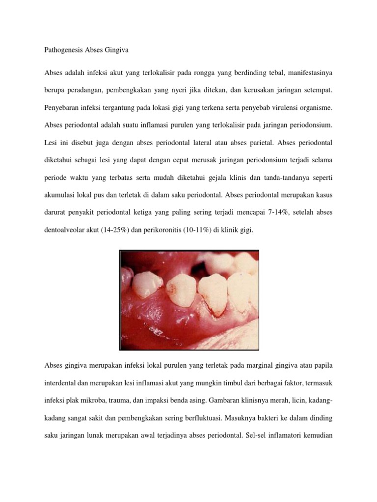 Pathogenesis Abses Gingiva | PDF