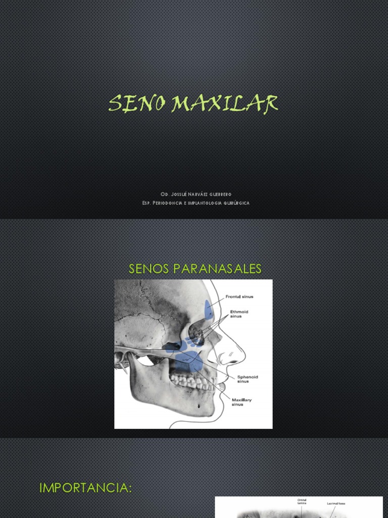 Seno Maxilar | PDF | Enfermedades y trastornos | Cabeza y cuello humanos