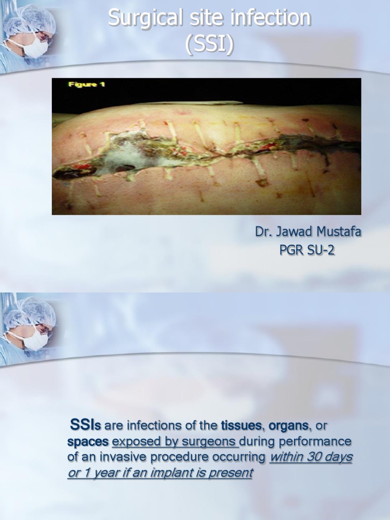 Presentation SSI | PDF | Surgery | Infection