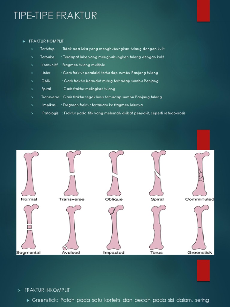 Tipe-Tipe Fraktur | PDF