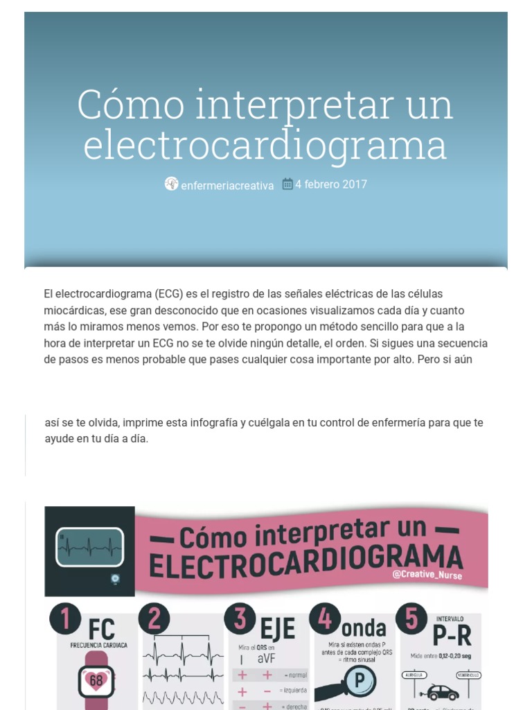 Cómo Interpretar Un Electrocardiograma | PDF