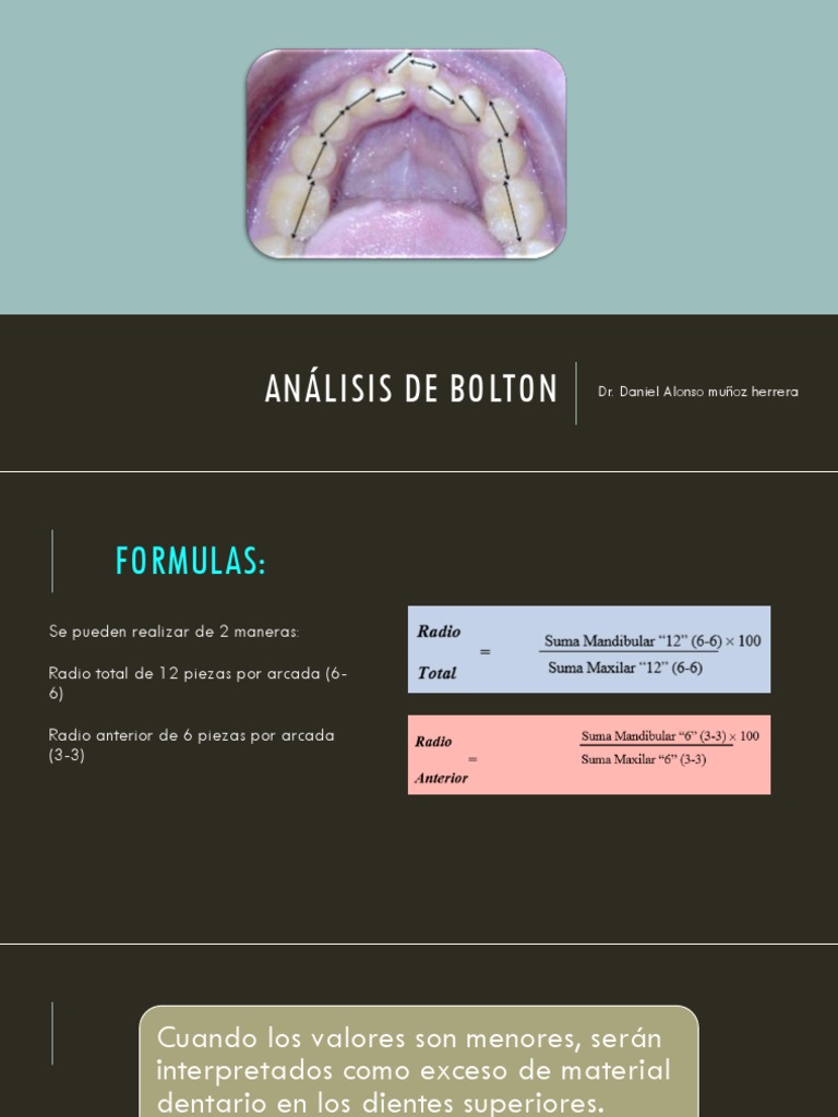 Análisis de Bolton | PDF