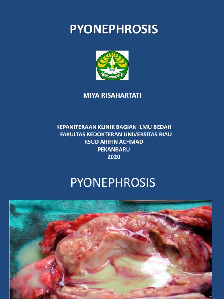 PYONEPHROSIS | PDF | Science & Mathematics