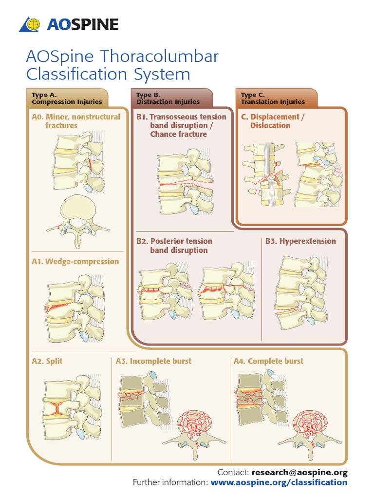 Aos Pcard100x150 ThoracoCS Mar18 PDF | PDF | Vertebral Column | Vertebra