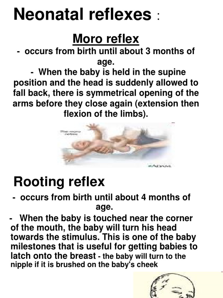 Neonatal Reflexes | PDF