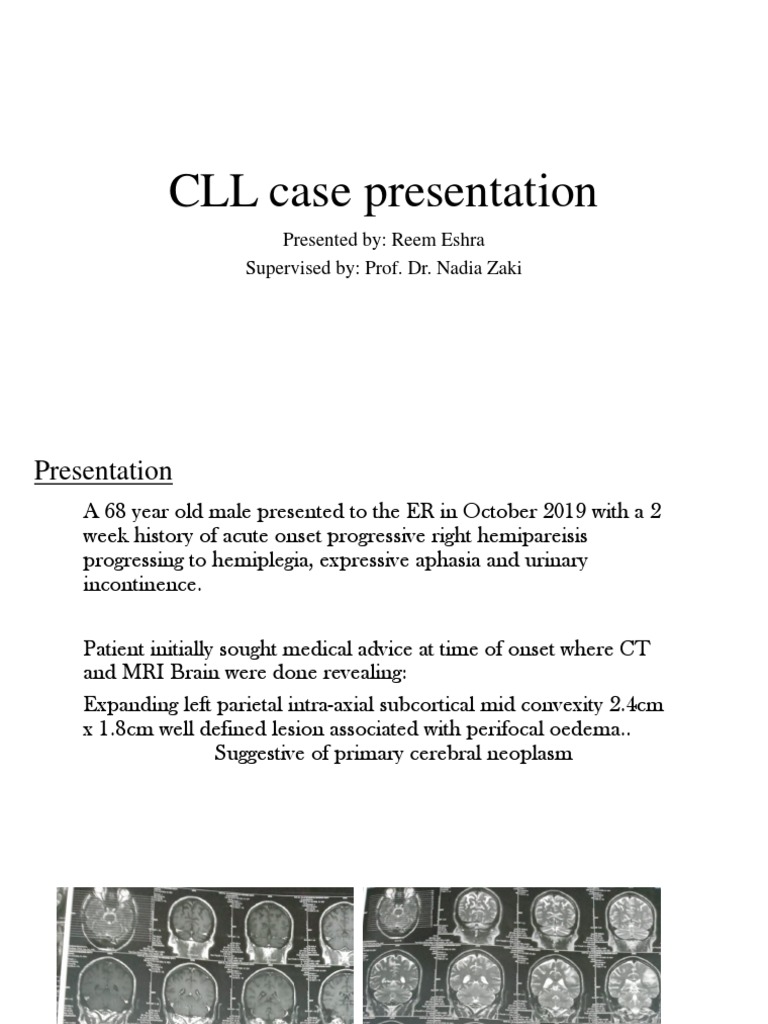 CLL Presentation with CNS Involvement | PDF | Brain Tumor | Diseases ...