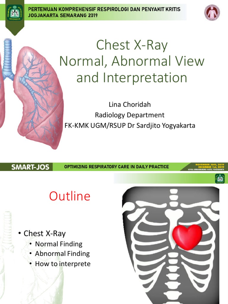 Chest X-Ray Interpretation Guide | PDF | Lung | Heart