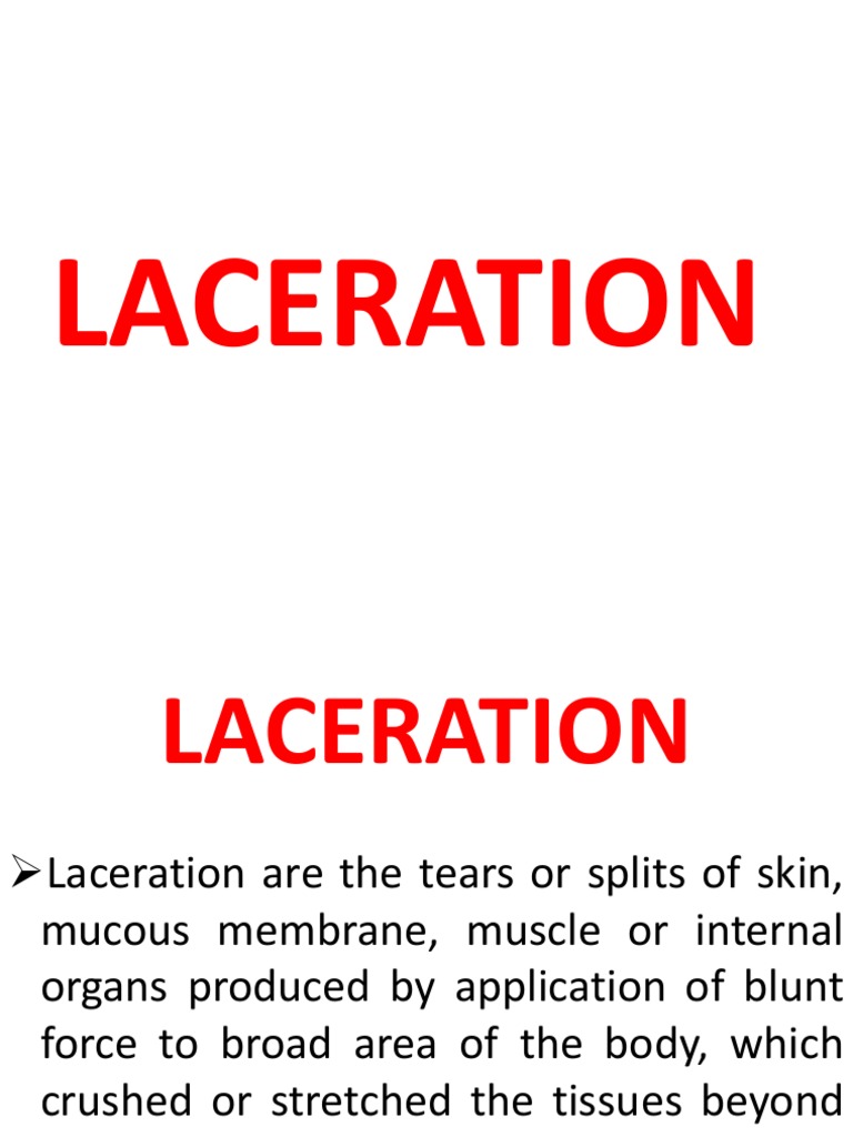 Mechanical Injuries - Lacerations | PDF | Wound | Skin