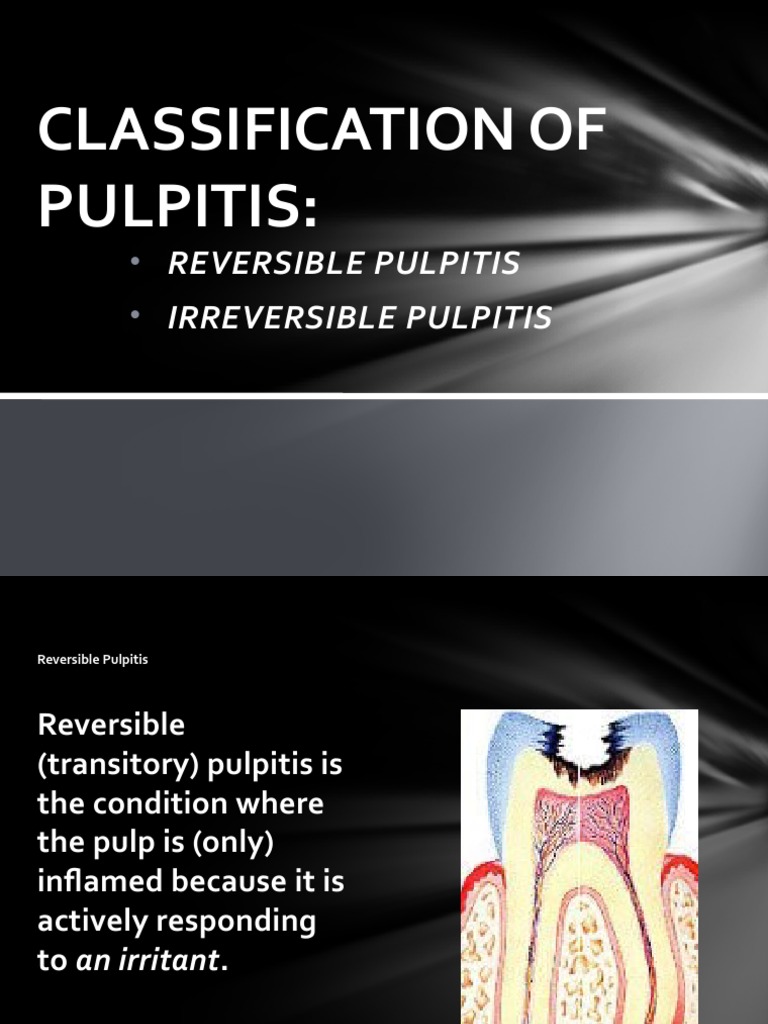 Classifying Pulpitis - Reversible vs Irreversible | PDF