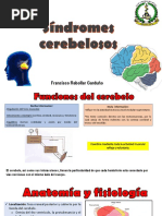 Síndromes Cerebelosos: Vermiano y Hemisferios | PDF | Cerebelo ...