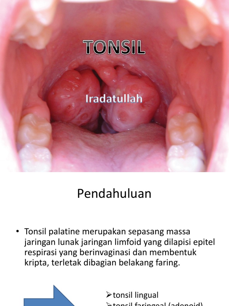 Anatomi dan Fungsi Tonsil | PDF | Kajian Bahasa Asing | Sains & Matematika