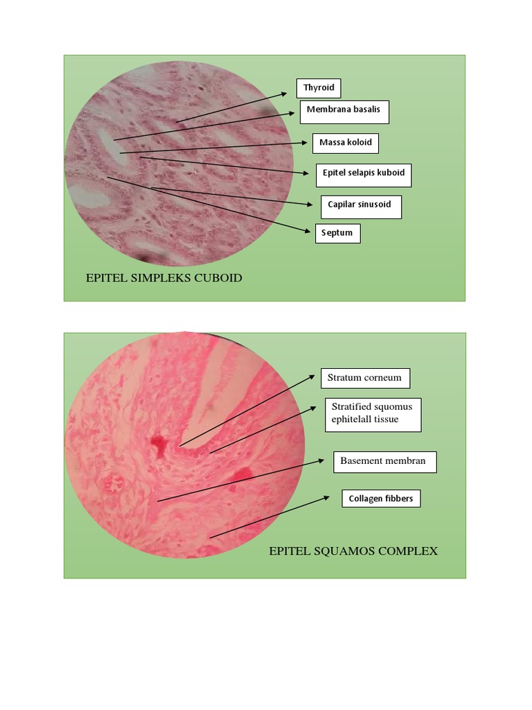 Nevi | PDF | Epithelium | Organ (Anatomy)