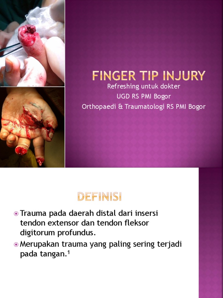 Finger Tip Injury Pmi | PDF
