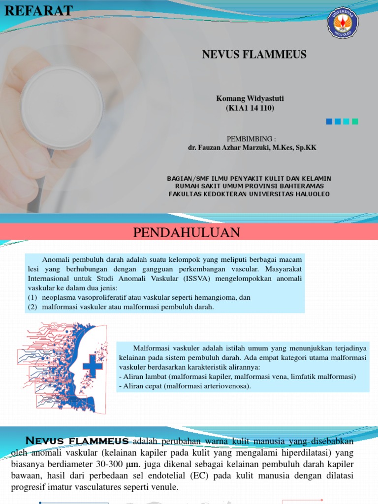 Nevus Flammeus: Gejala dan Pengobatan | PDF