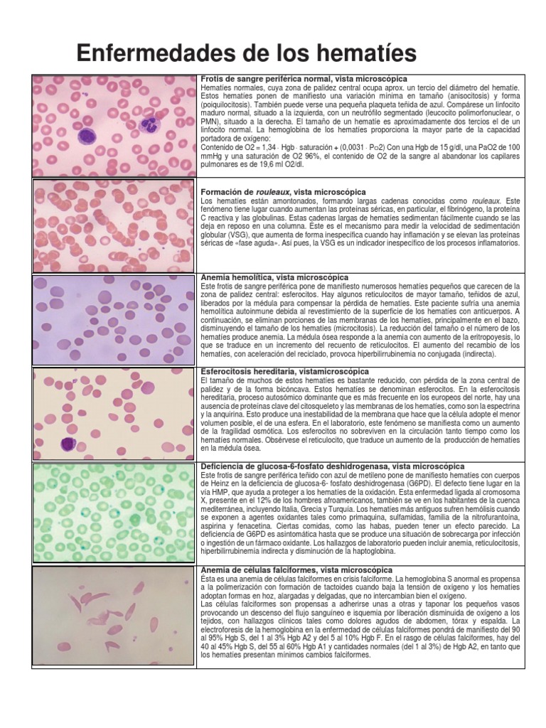 Atlas de Hematolgia y Enfermedades de Hematies | PDF | Leucocito ...