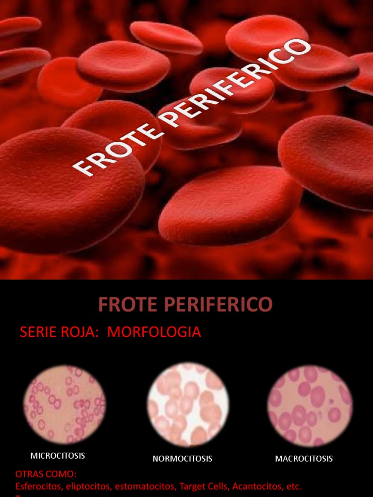 Frote Periferico | PDF | Leucocito | Plaqueta