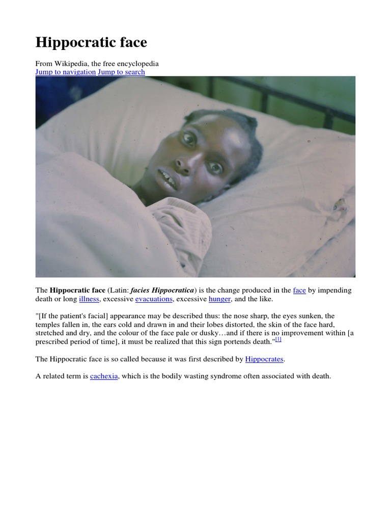 Hippocratic Face | PDF