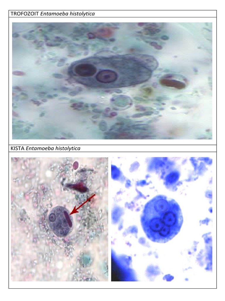 PRINT OUT Preparat Protozoa Usus | PDF