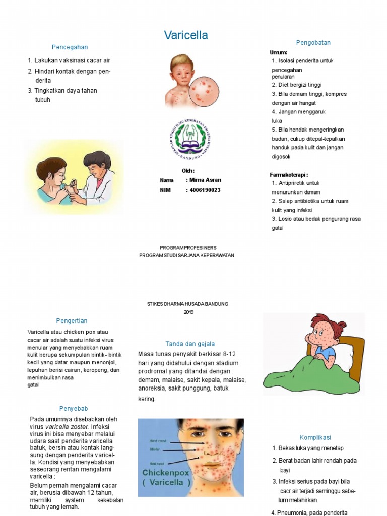 Leaflet Varicella | PDF