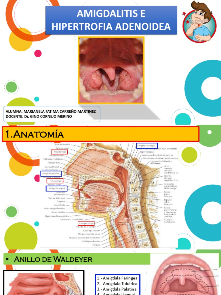 amigdalitis e hipertrofia adenoidea | Lengua | Linfocitos