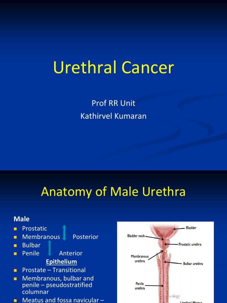 Urethral Cancers | PDF | Prostate | Epithelium