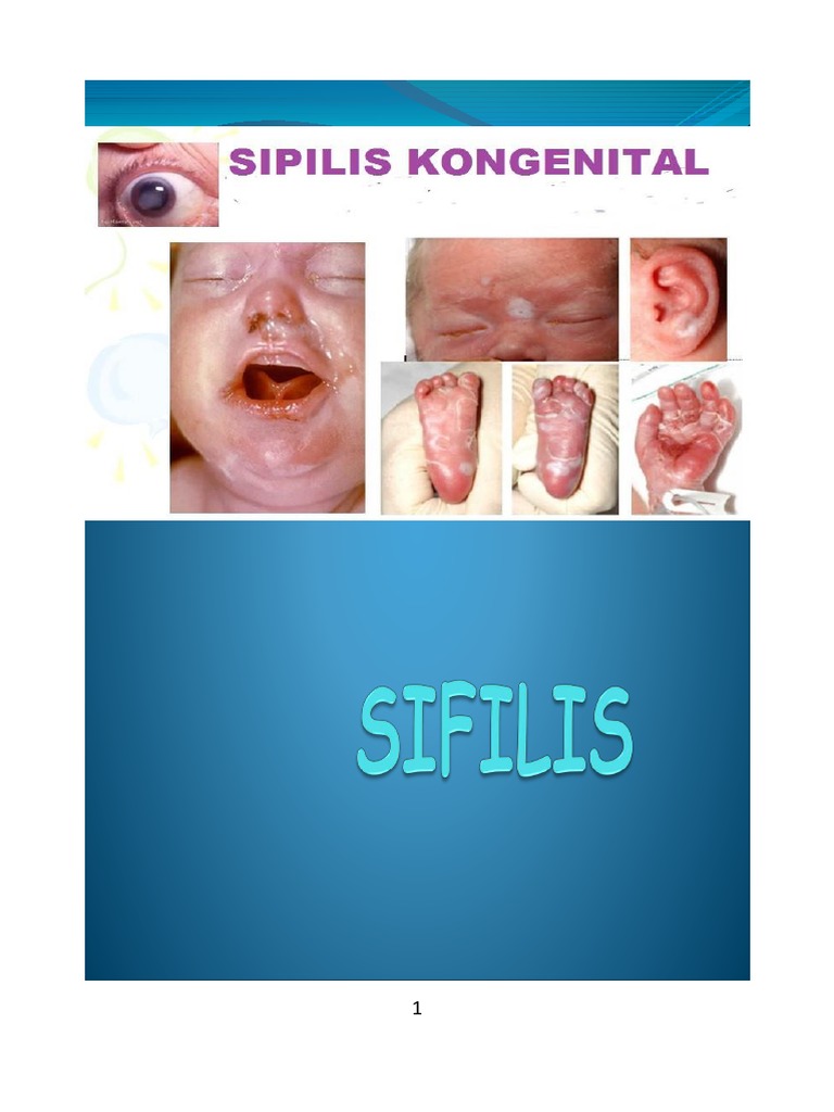 Sifilis Kongenital dan Penanganannya | PDF