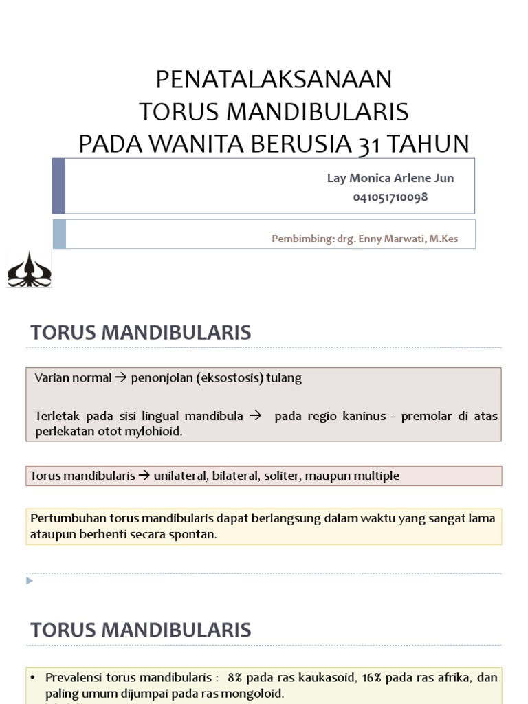 Torus Mandibularis | PDF