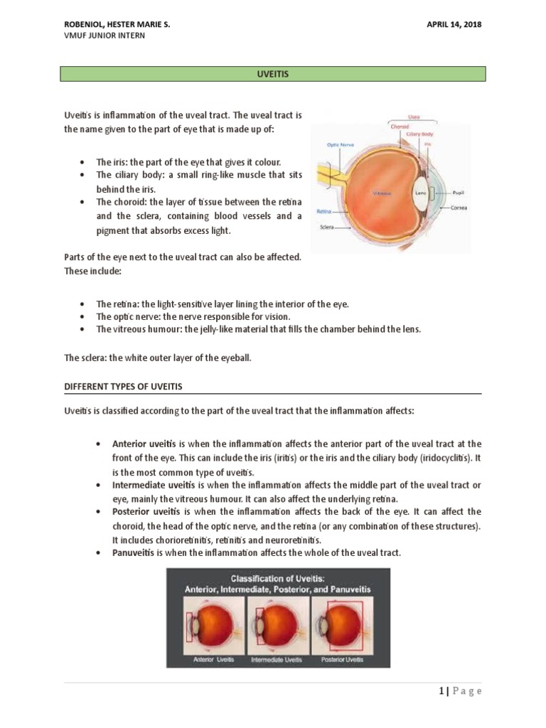 Uveitis and Iritis | PDF | Autoimmunity | Eye