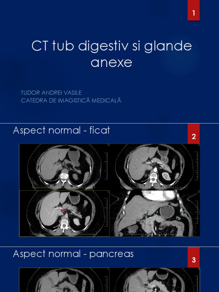 CT Imaging of Digestive Organs | PDF