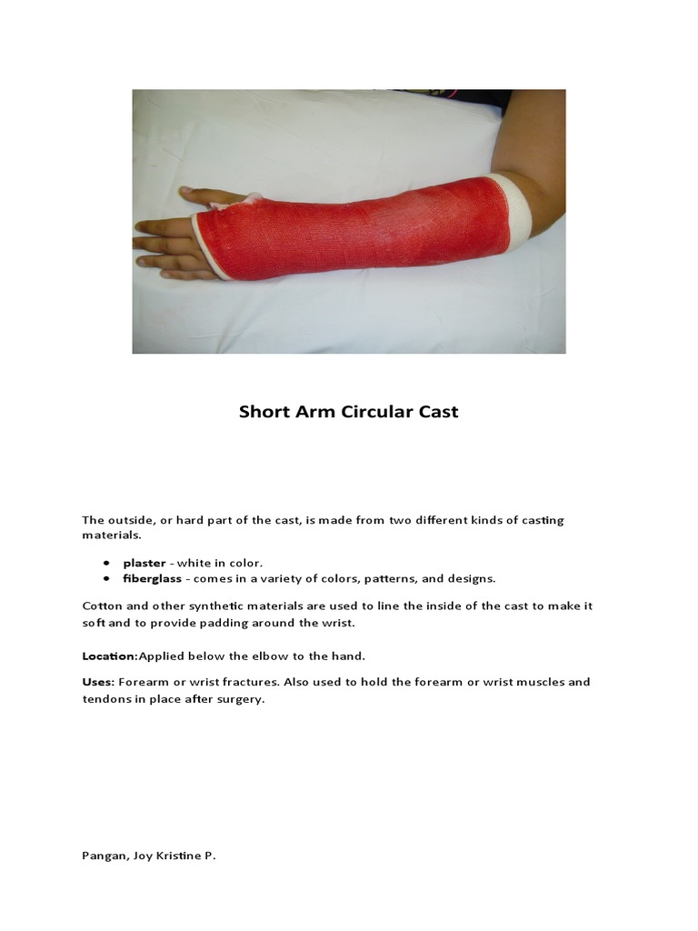 Short Arm Circular Cast | Download Free PDF | Hand | Arm