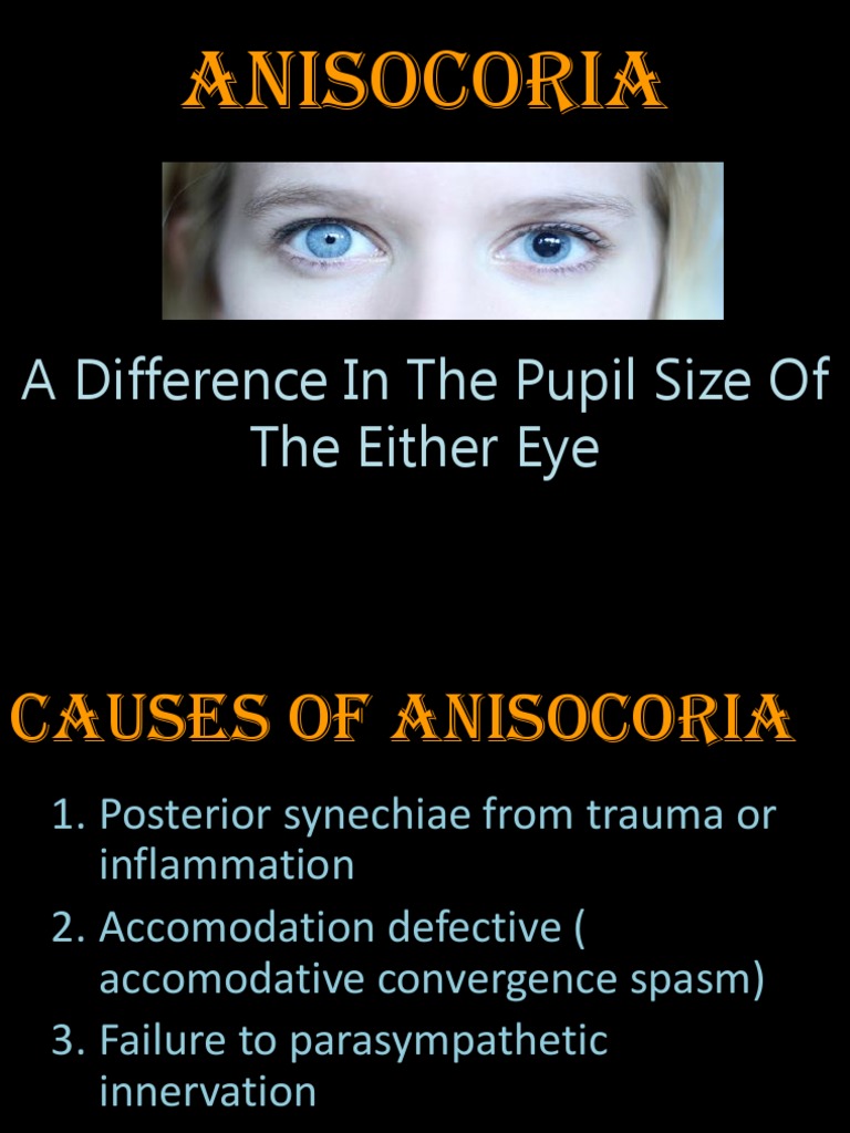 Anisometropia | PDF | Eye | Ophthalmology