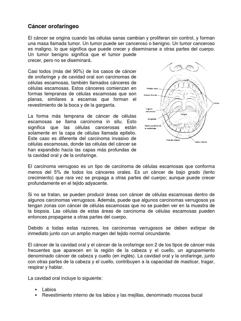 Cáncer Orofaríngeo | PDF | Biopsia | Cáncer