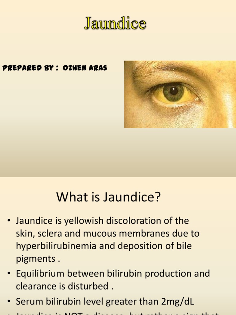 A Comprehensive Review of Jaundice: Causes, Types, Diagnosis, and ...
