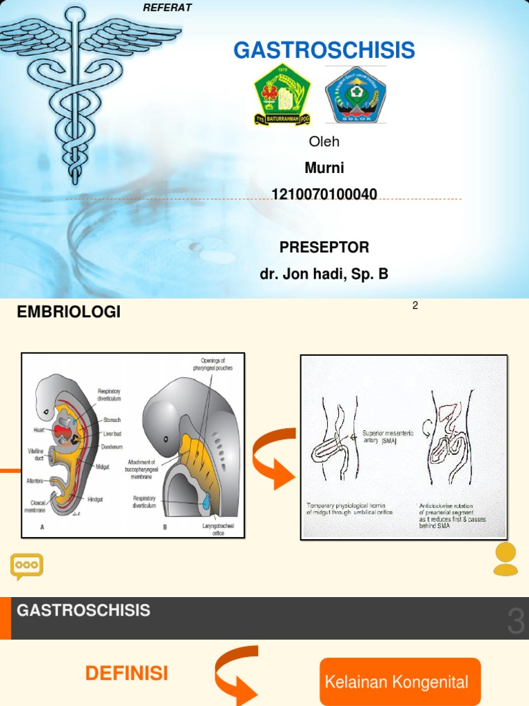 Gastroschisis | PDF