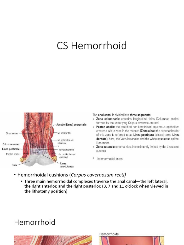 Hemorrhoid | PDF | Hemorrhoid | Rtt