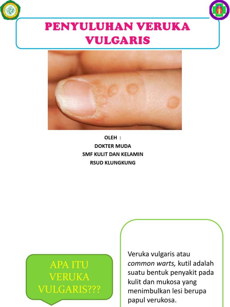 Veruka | PDF
