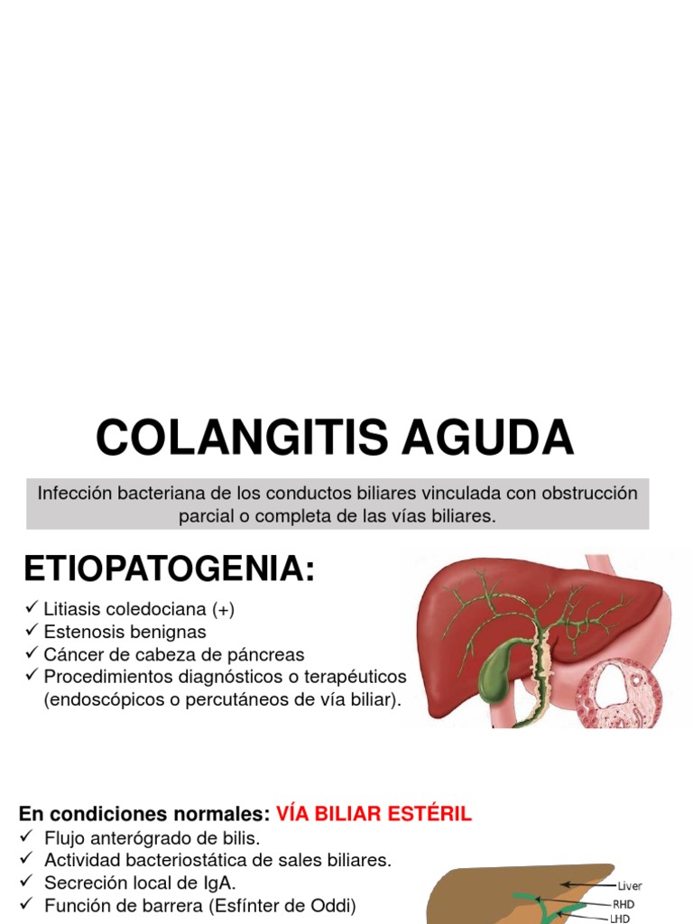 Colangitis Aguda: Diagnóstico y Tratamiento | PDF | Sistema exocrino ...