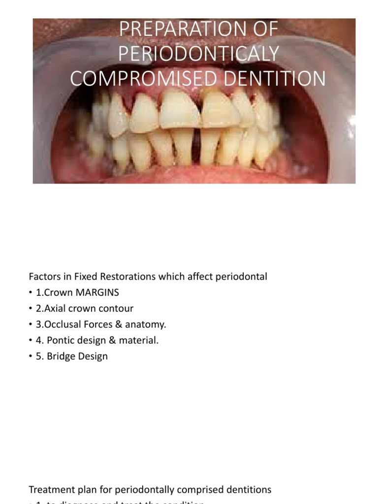 Treatment of Periodontically Compromised de | PDF | Human Tooth ...