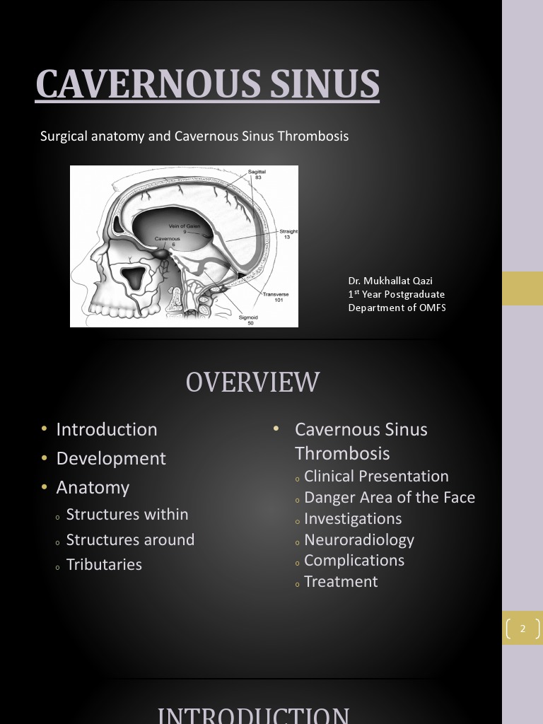 Cavernous Sinus CVT | PDF | Thrombosis | Human Head And Neck